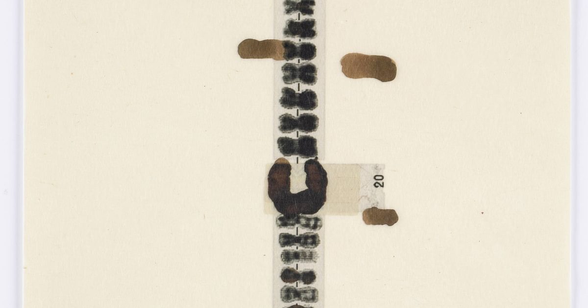 Suite ADN, XX XY, no 20 | Musée national des beaux-arts du Québec - MNBAQ